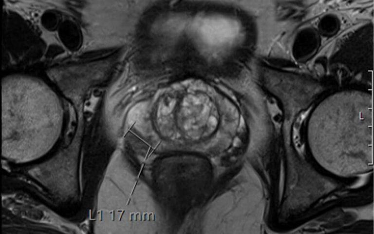 MRT der Prostata: Vorsorge & Untersuchung | RIZ Augsburg