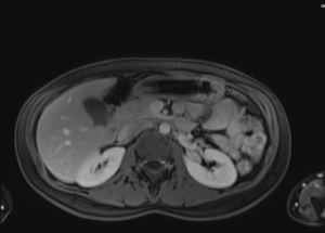 Oberbauch und Organe | RIZ Augsburg