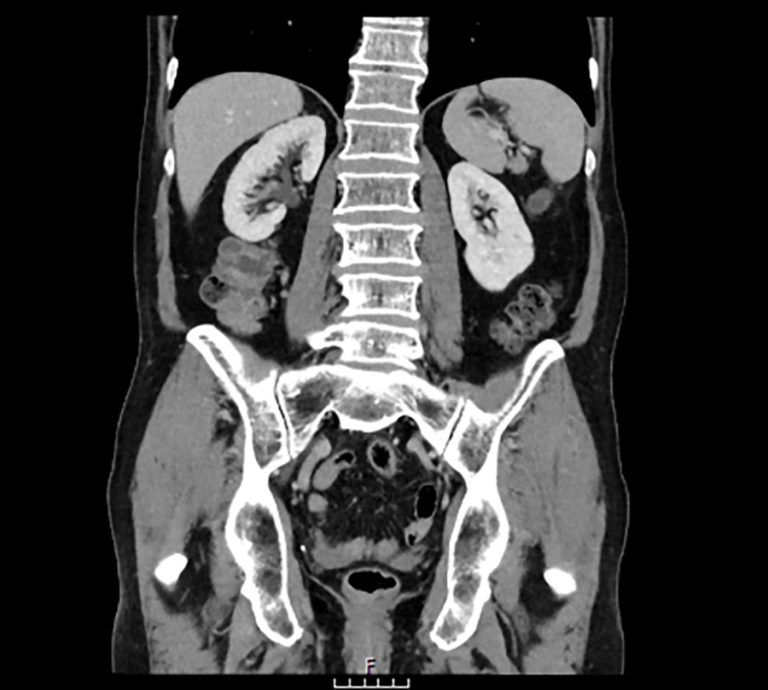 Oberbauch und Organe | RIZ Augsburg